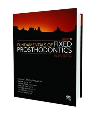 Fundamentals of Fixed Prosthodontics, Herbert T Shillingburg - Shop ...