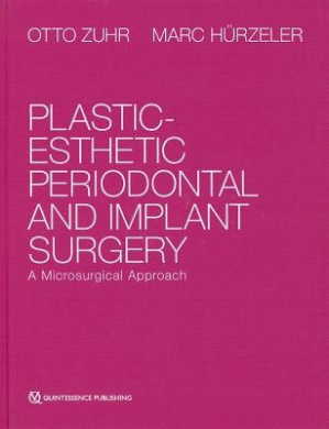 Plastic-Esthetic Periodontal and Implant Surgery, Otto Zuhr - Shop Online for Books in Australia